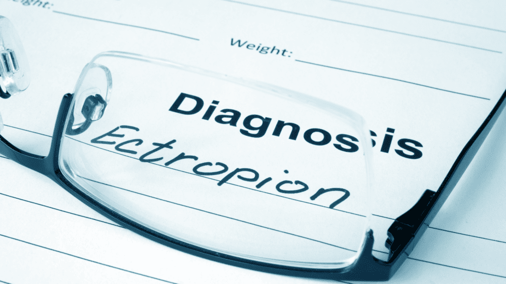 Understanding Ectropion: Symptoms, Causes, and Treatments - Tennessee ...